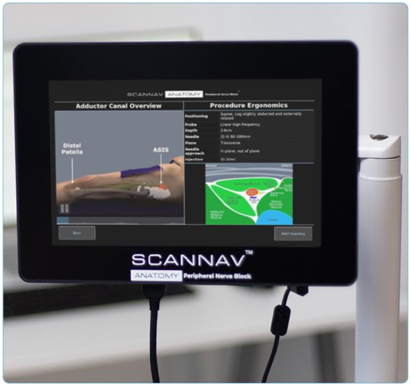 Scannav Anatomy Peripheral Nerve Block Pnb Intelligent Ultrasound